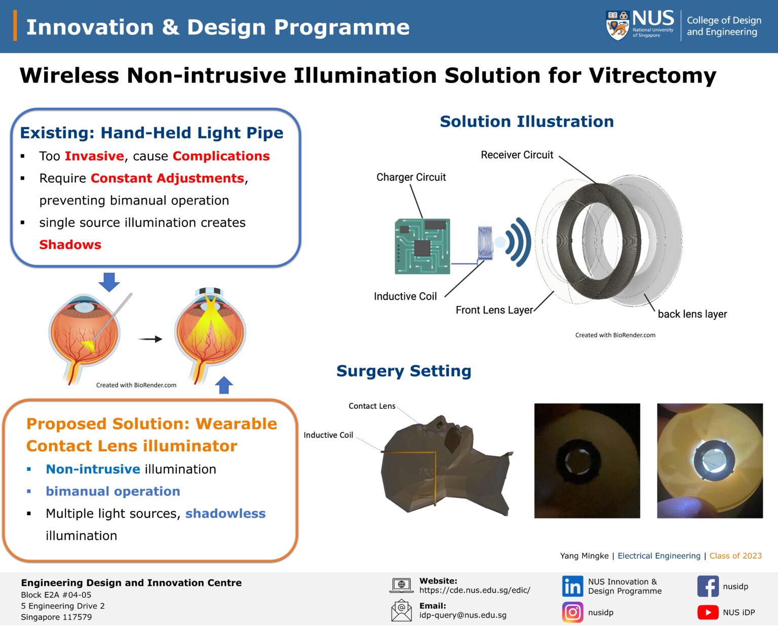 Wireless non-intrusive illumination solution for vitrectomy surgery ...