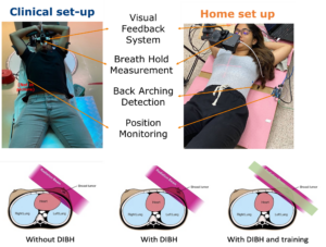 Deep-inspiration breath hold trainer for breast cancer radiotherapy ...